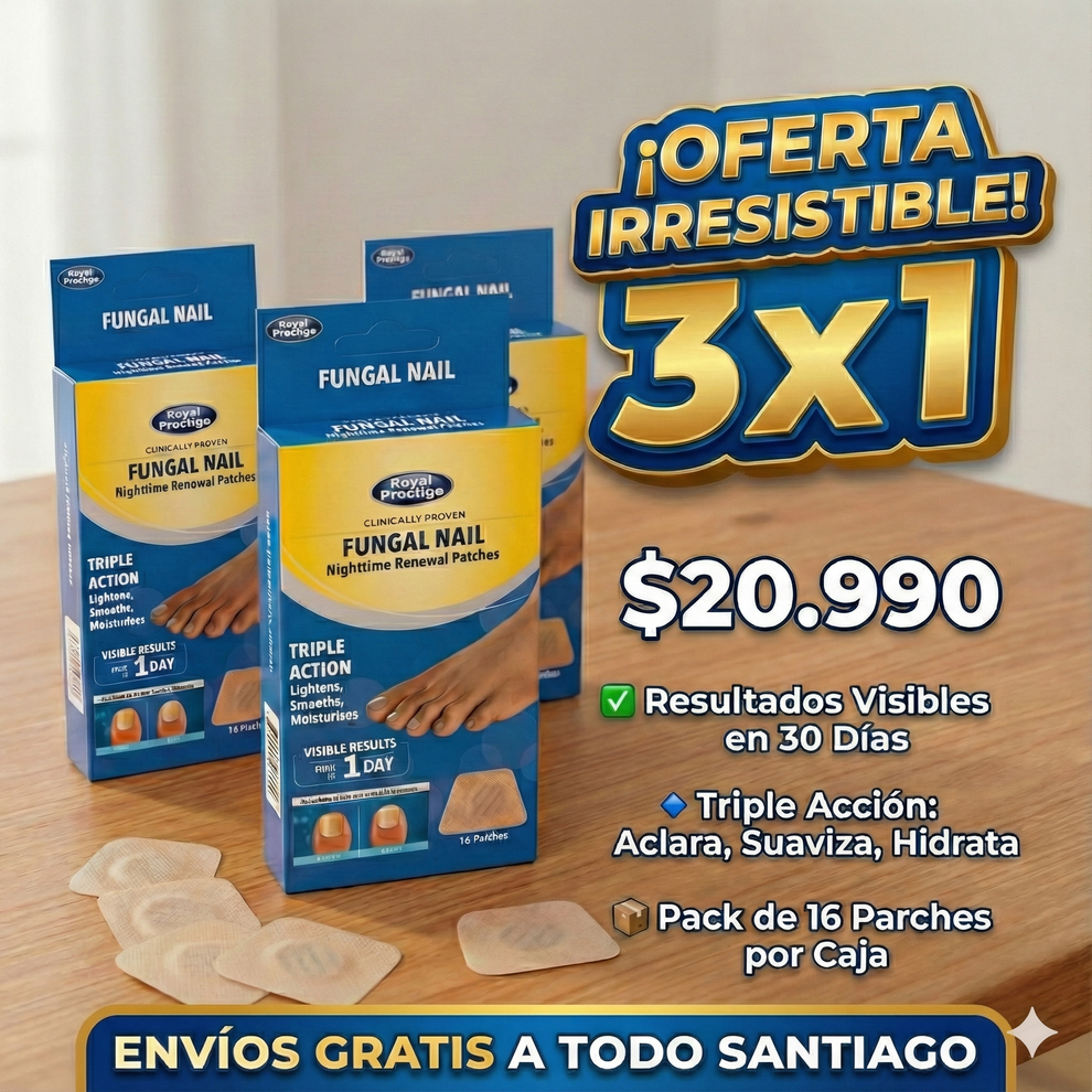 Elimina la infección de tus uñas por el hongo, irregularidades, colora ...